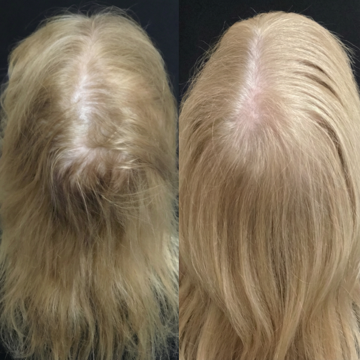 Alyra Hair Enhancer Mist